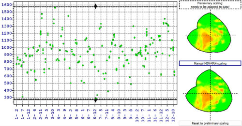 Arbotom 6 Sonic Tomograph Expert Model (16 Sensors) — arbortools