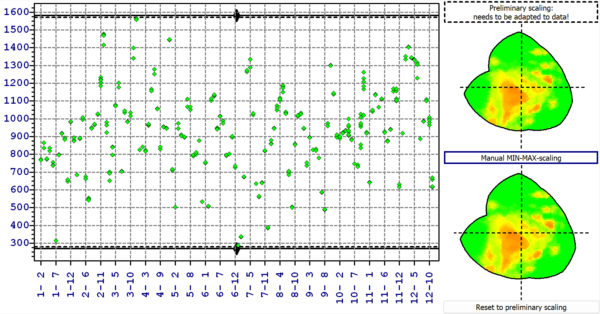 Arbotom 6 Sonic Tomograph Expert Model (16 Sensors) — arbortools