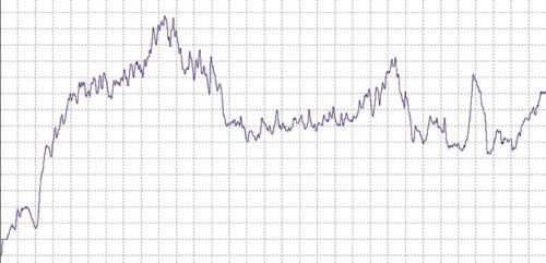 Resistograph R650-EA (Standard, Temperate Trees & Timber Inspection ...