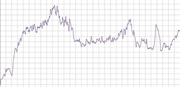 Resistograph R650-EA (Standard, Temperate Trees & Timber Inspection ...